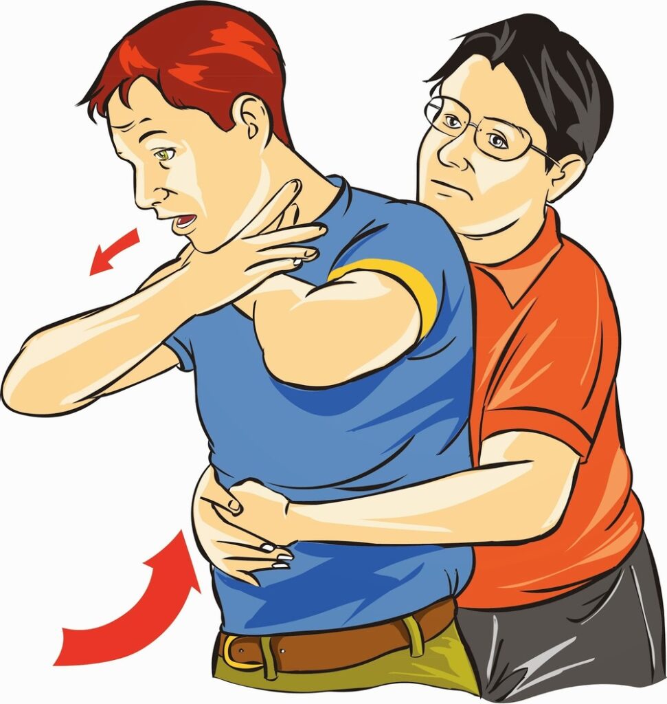 The Heimlich Maneuver: A Life-Saving Skill To Rescue A Choking Victim.